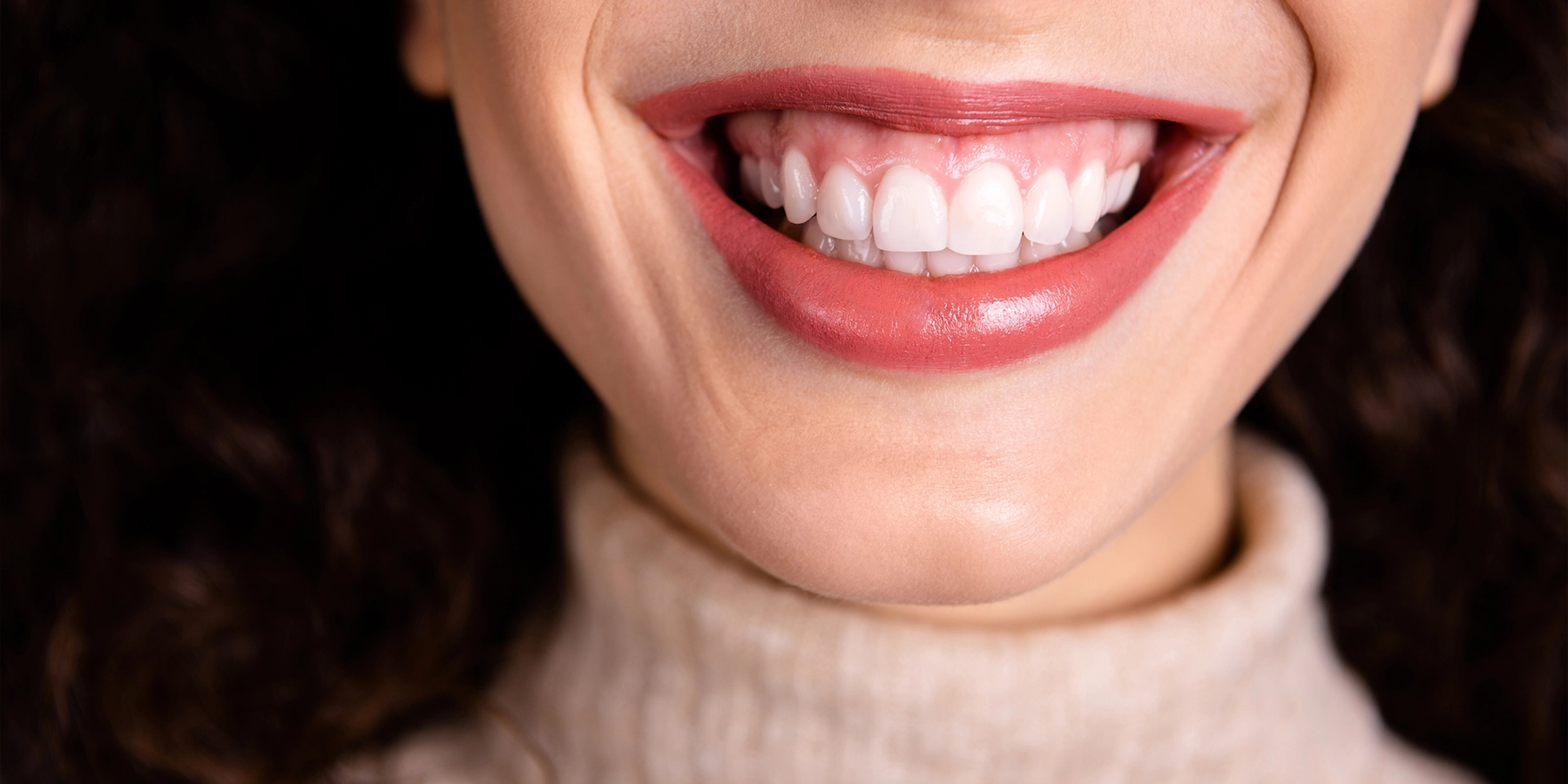 Is too much gum showing when you smile? - Calamvale Cosmetic Dental